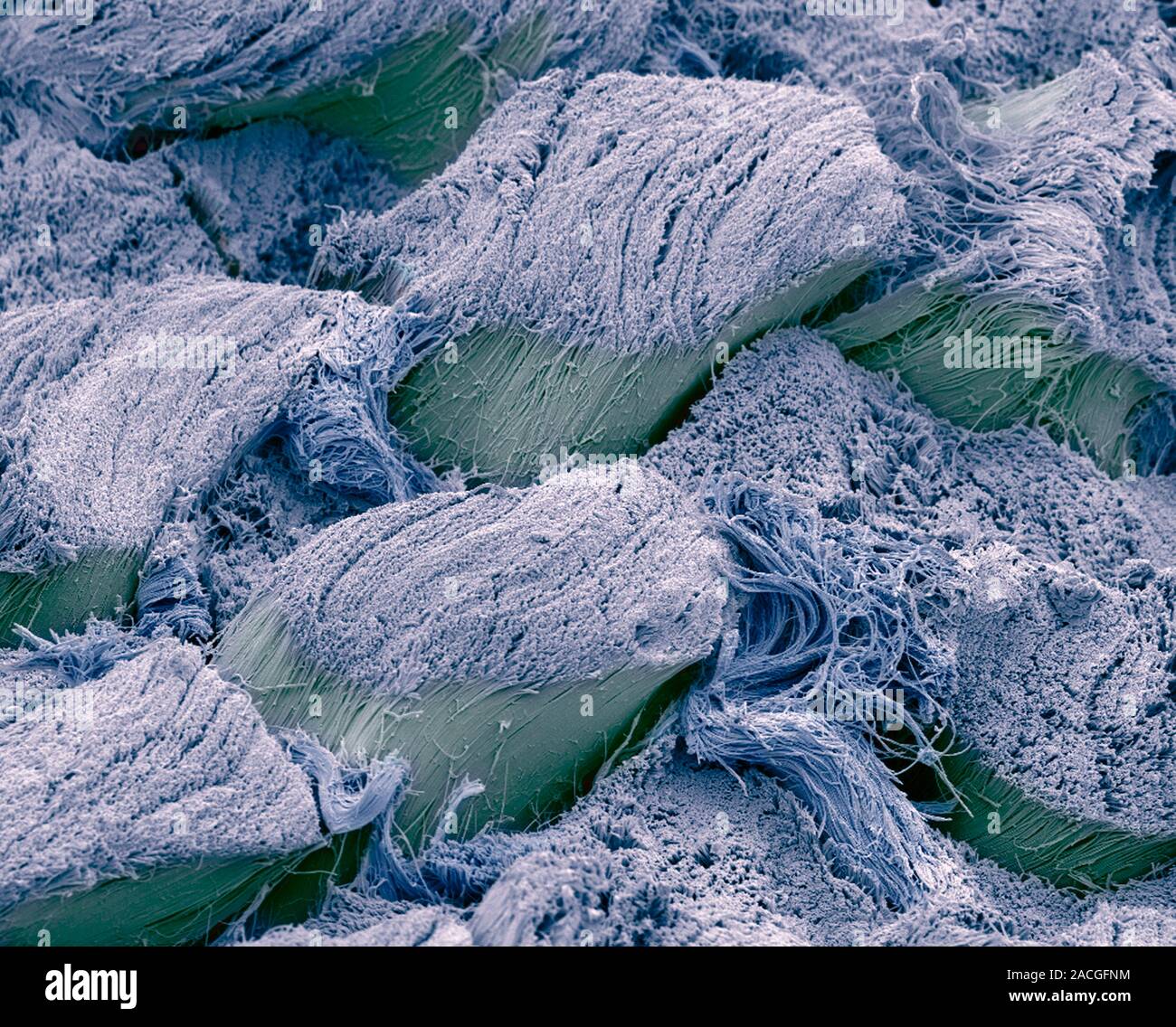 Snake dermis fibres, coloured scanning electron micrograph (SEM). The ...