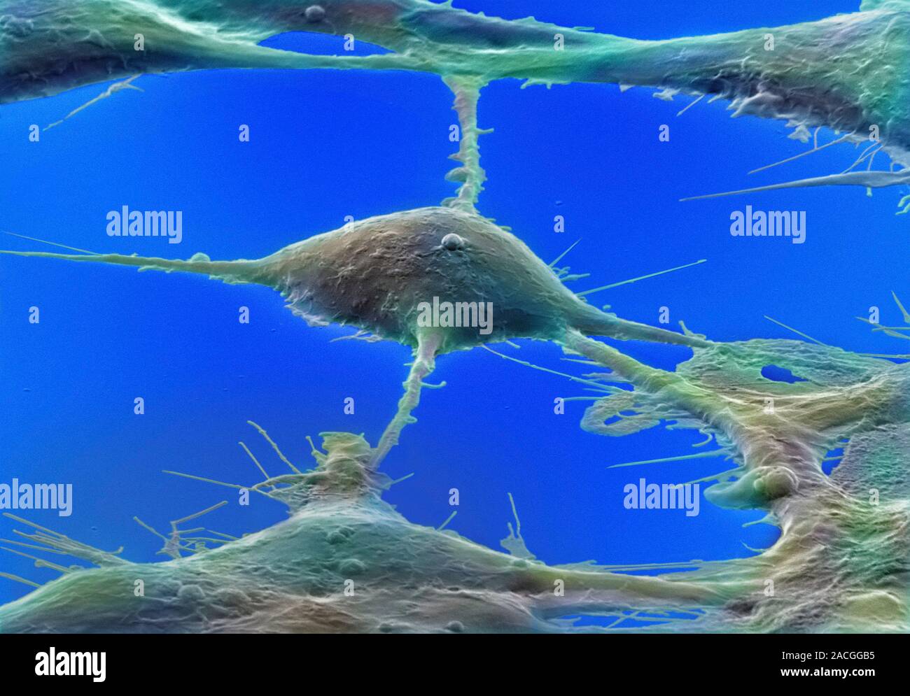 Human embryonic kidney cells. Coloured scanning electron micrograph ...