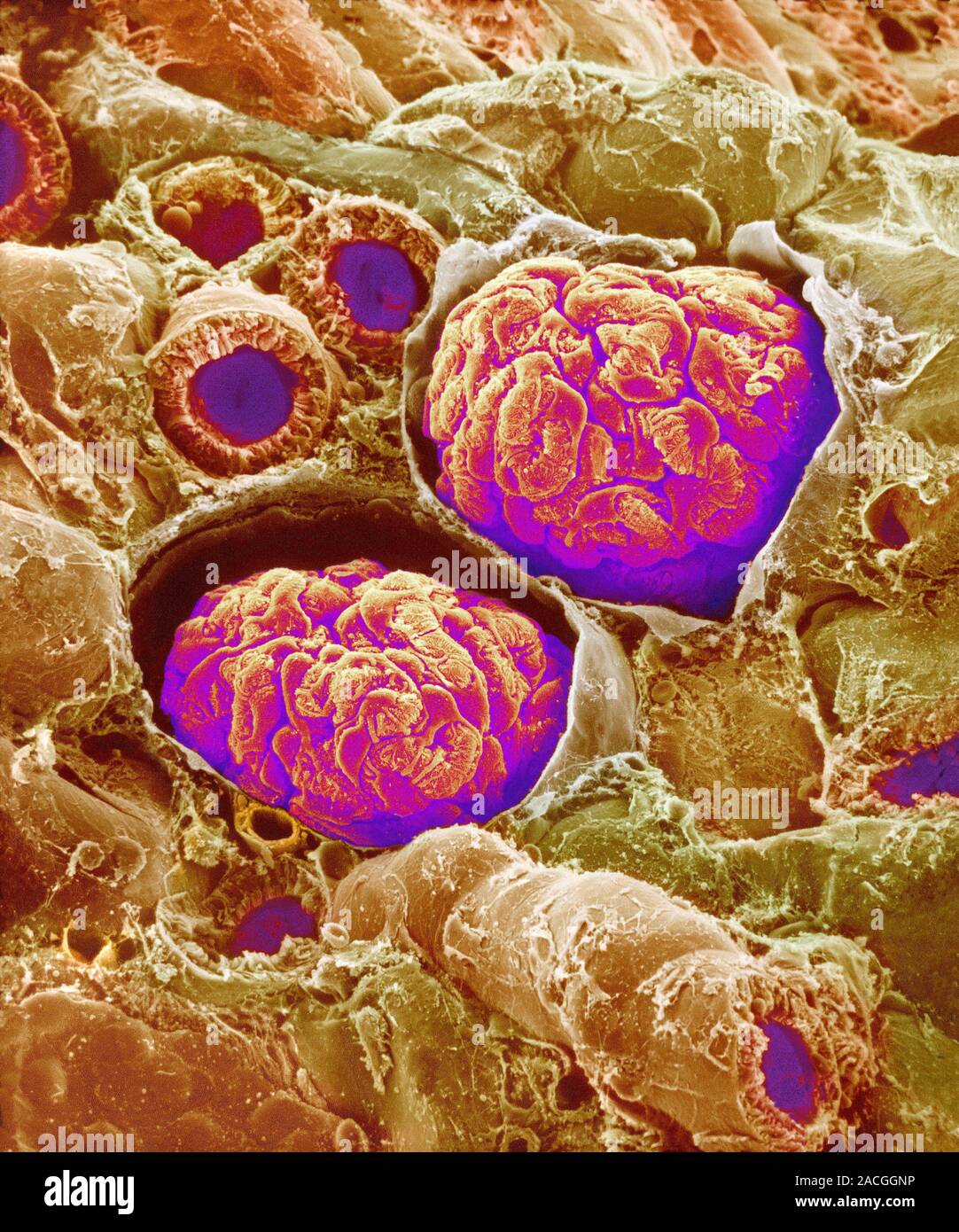Kidney glomeruli. Coloured scanning electron micrograph (SEM) of two ...