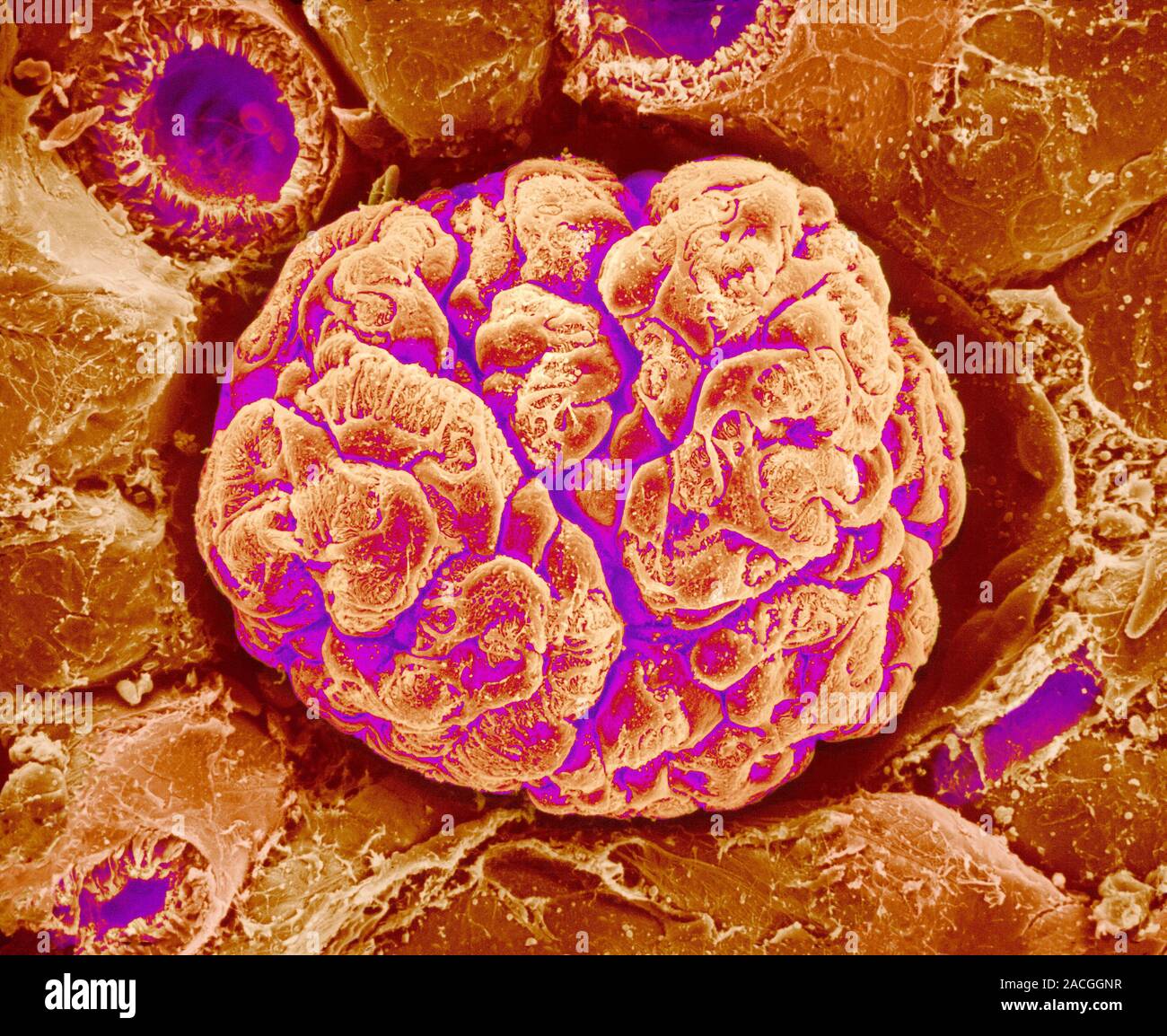 Kidney glomerulus. Coloured scanning electron micrograph (SEM) of a ...