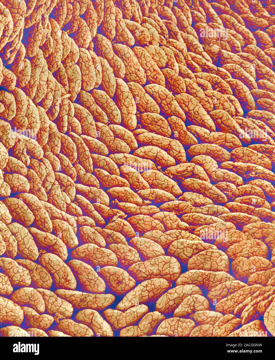 Intestinal Lining Coloured Scanning Electron Micrograph Sem Of Villi From The Small Intestine