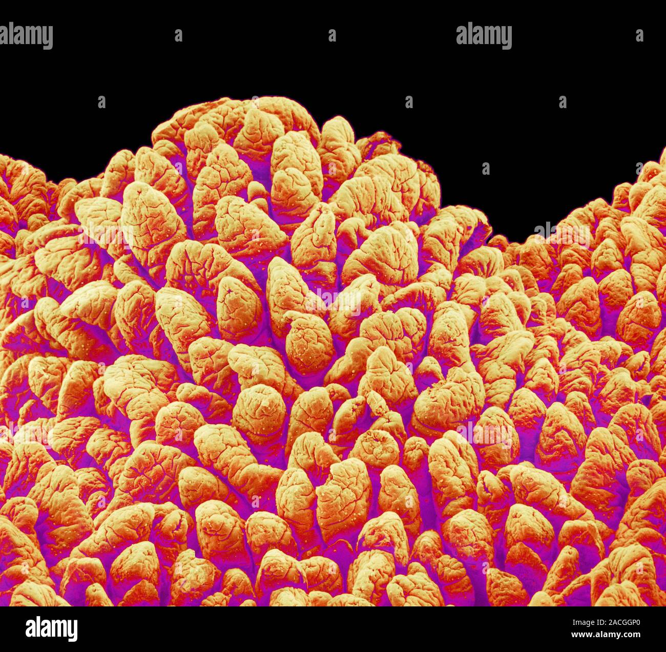 Intestinal Lining Coloured Scanning Electron Micrograph Sem Of Villi From The Small Intestine