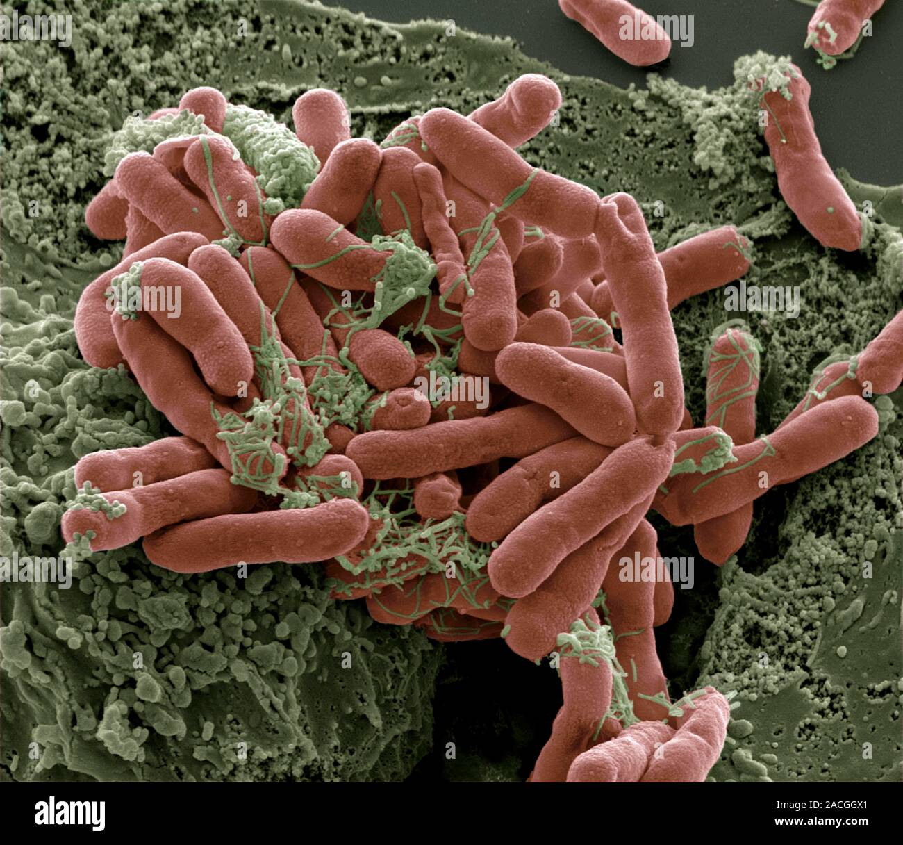 Bacterial contamination, coloured scanning electron micrograph (SEM ...