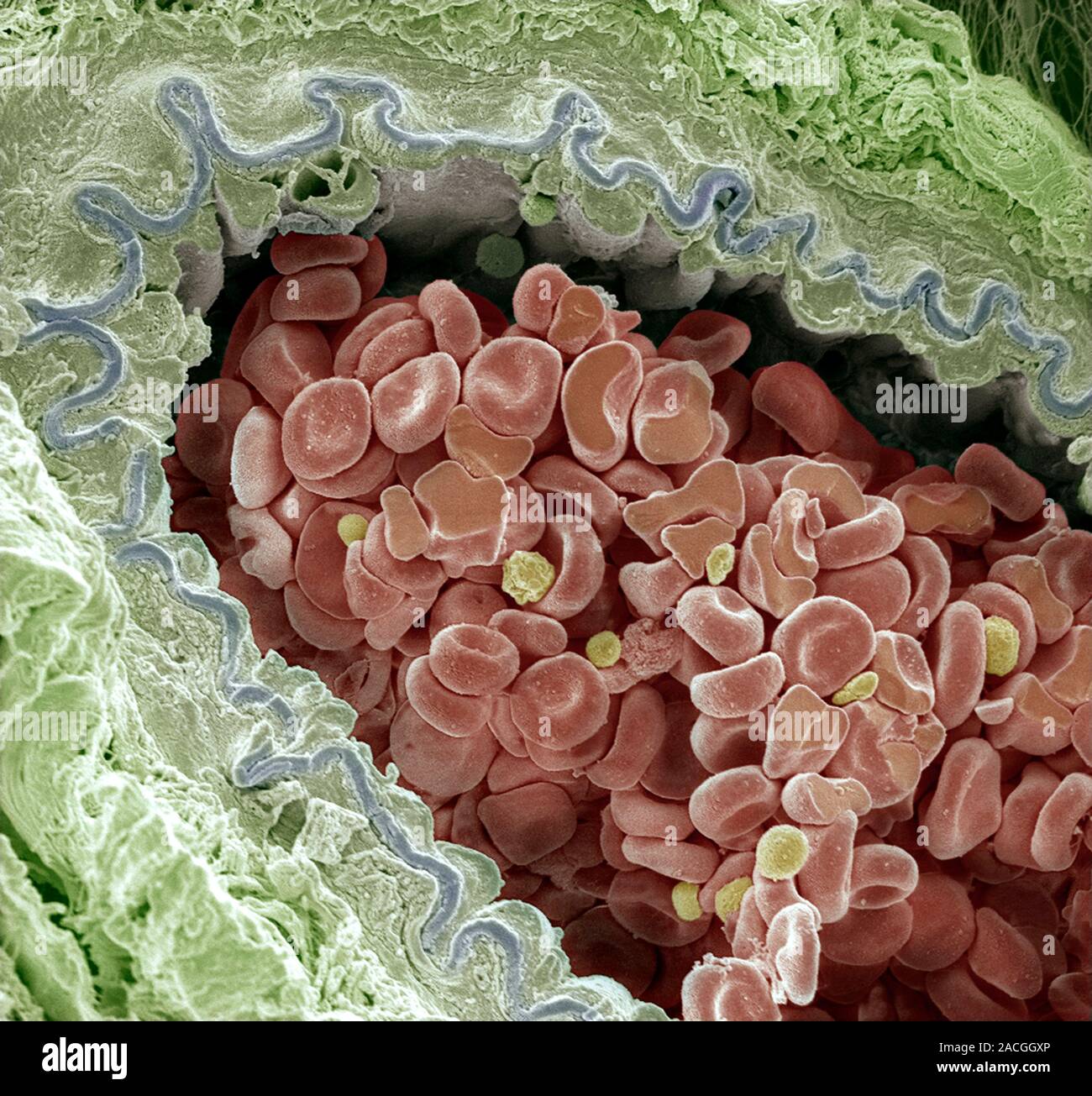 Elastic artery cross-section, coloured scanning electron micrograph (SEM). This section is ...