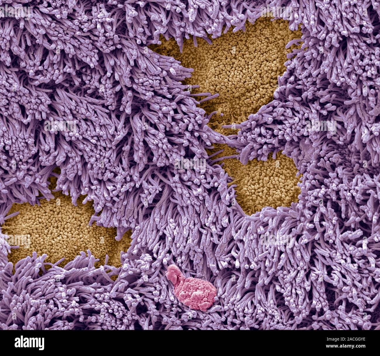 Nasal epithelium, coloured scanning electron micrograph (SEM). The ...