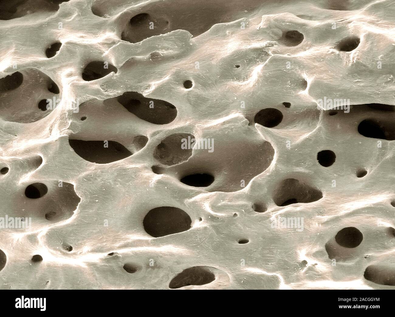 Fossilised dinosaur bone, coloured scanning electron micrograph (SEM ...