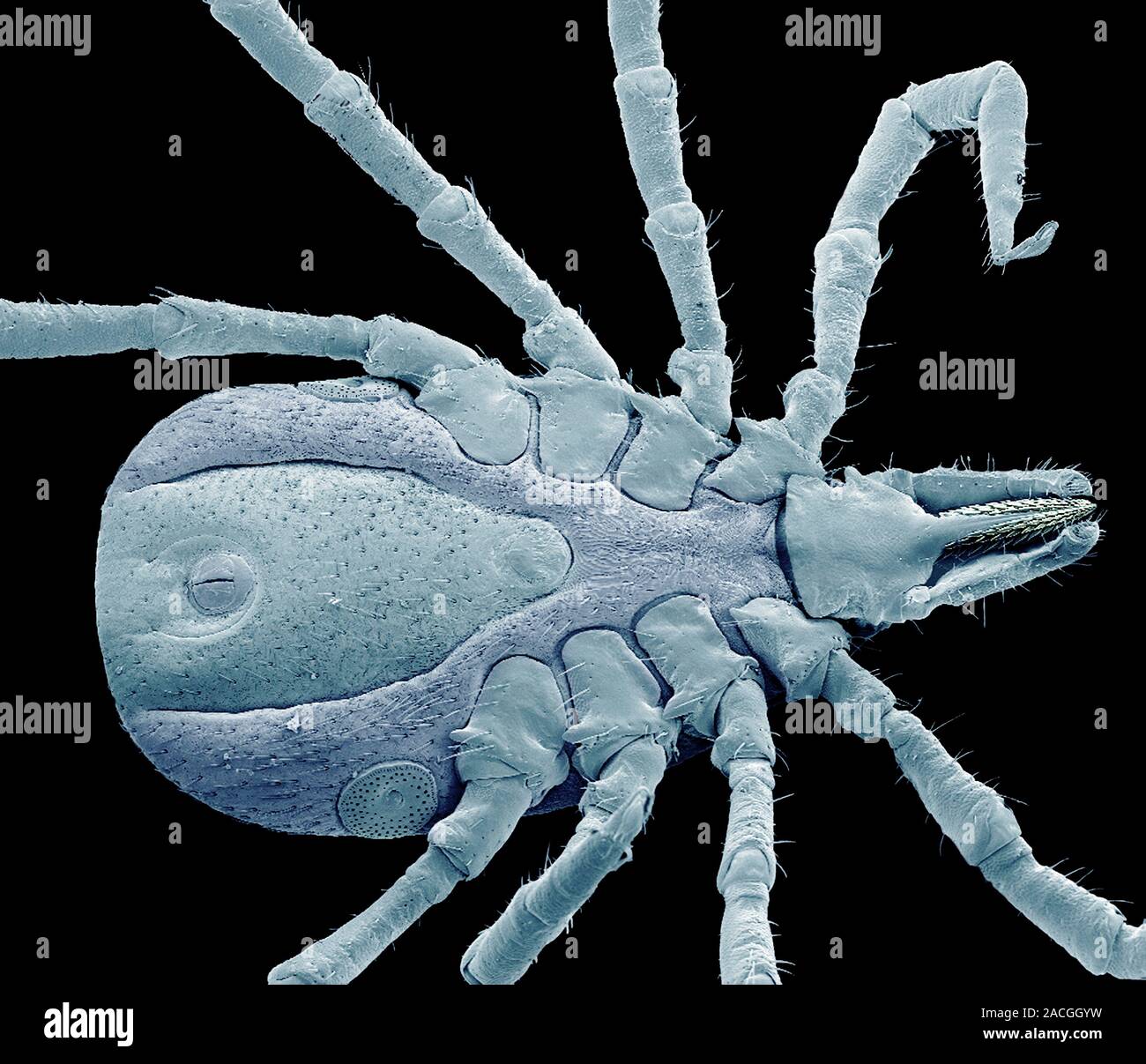 Tick, coloured scanning electron micrograph (SEM). This is the ventral ...