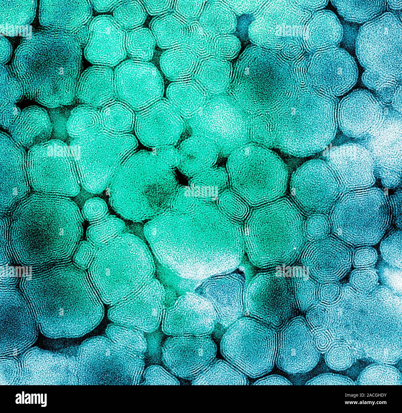 Liposome vesicles. Coloured transmission electron micrograph (TEM) of ... Liposome vesicles. Coloured transmission electron micrograph (TEM) of ...