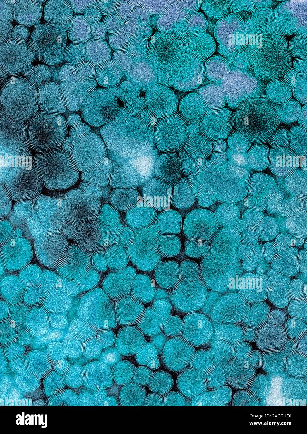 Liposome vesicles. Coloured transmission electron micrograph (TEM) of ... Liposome vesicles. Coloured transmission electron micrograph (TEM) of ...