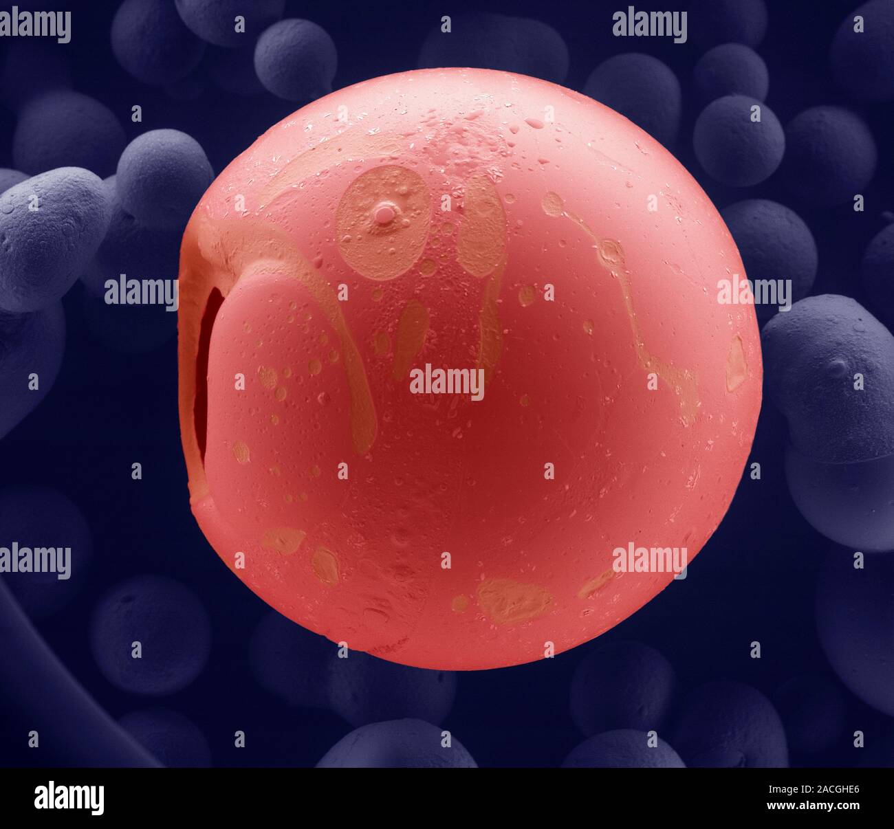 PLGA biomedical device, coloured scanning electron micrograph (SEM ...