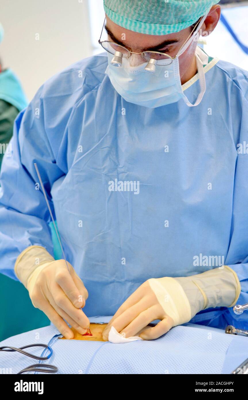 Slipped disc microendoscopy surgery. Surgeon performing an operation on ...