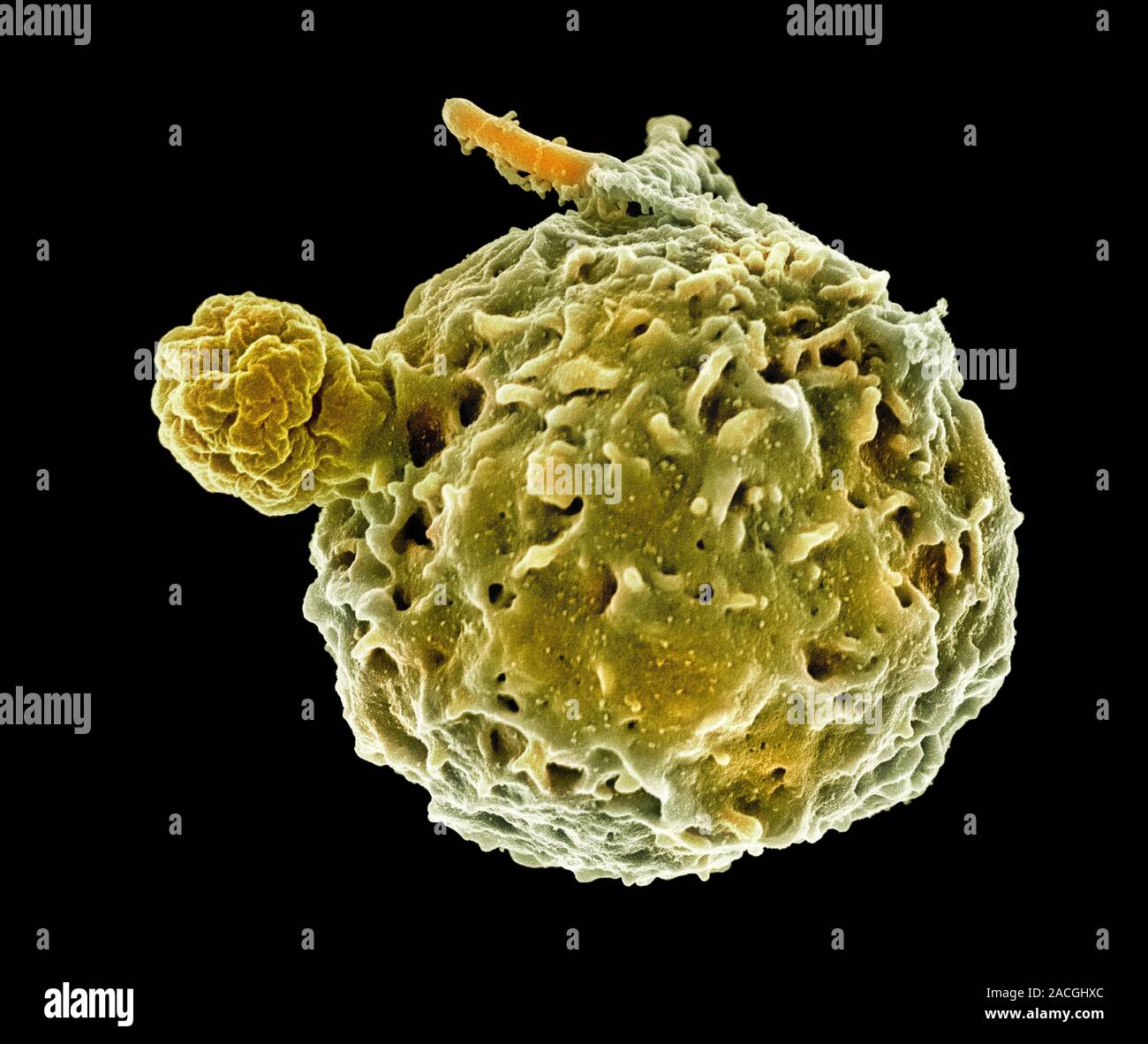 Neutrophil engulfing TB bacteria. Coloured scanning electron micrograph ... Neutrophil engulfing TB bacteria. Coloured scanning electron micrograph ...