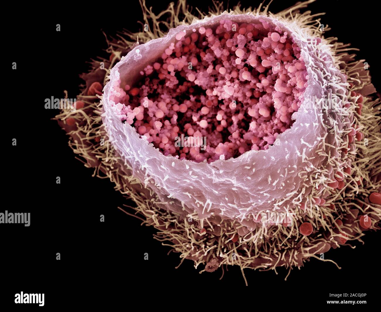 Chlamydia infection. Coloured scanning electron micrograph of a ...