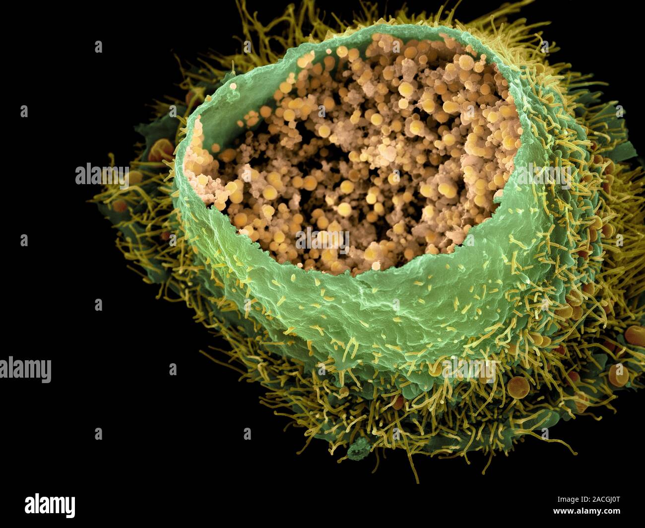 Chlamydia infection. Coloured scanning electron micrograph of a ...