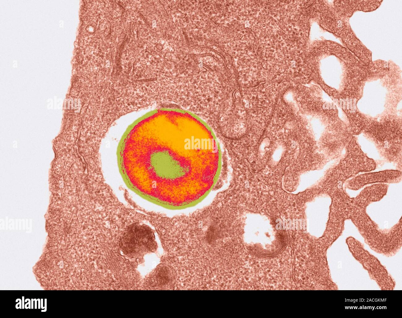 Bacterial invasion of pulmonary epithelial cells by Staphylococcus ...