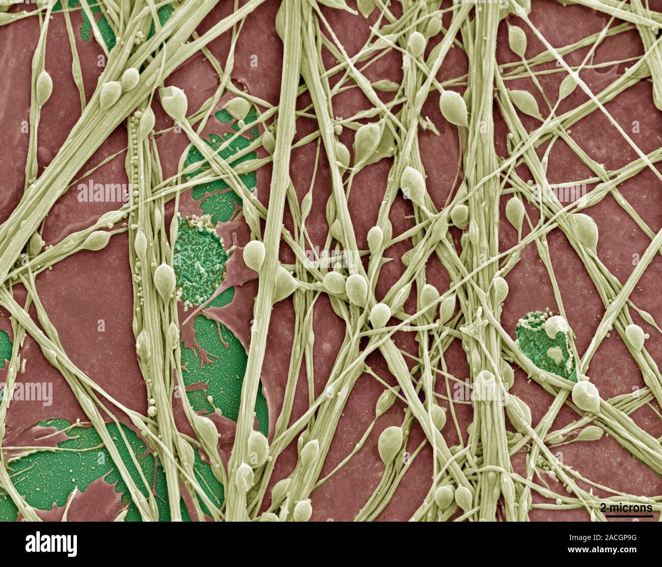 Synapse nerve junctions. Coloured scanning electron micrograph (SEM) of ...