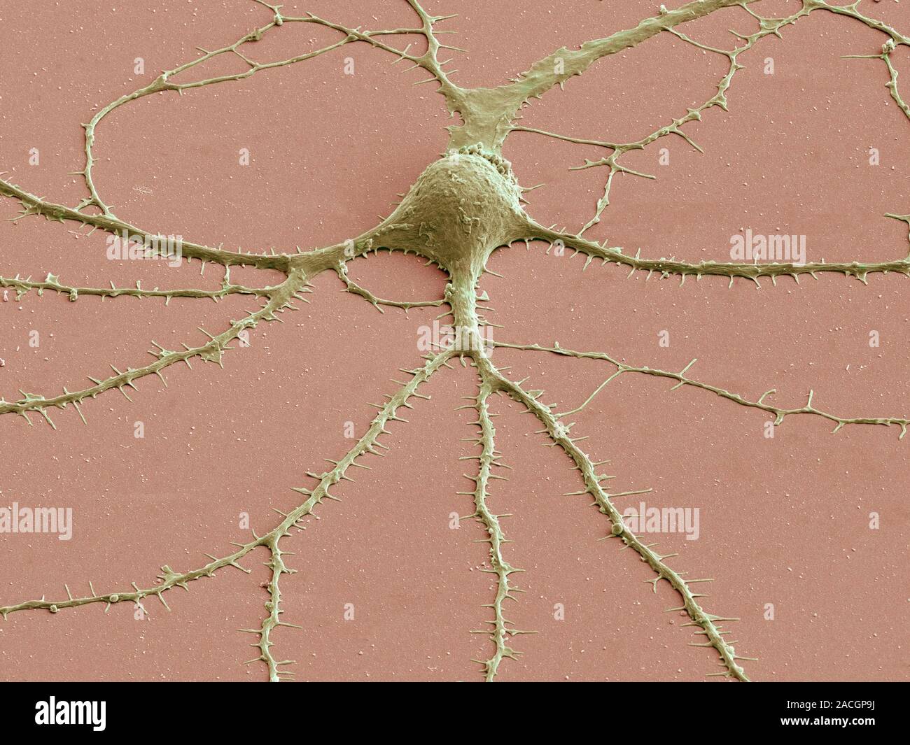 Nerve cell. Coloured scanning electron micrograph (SEM) of a cultured ...