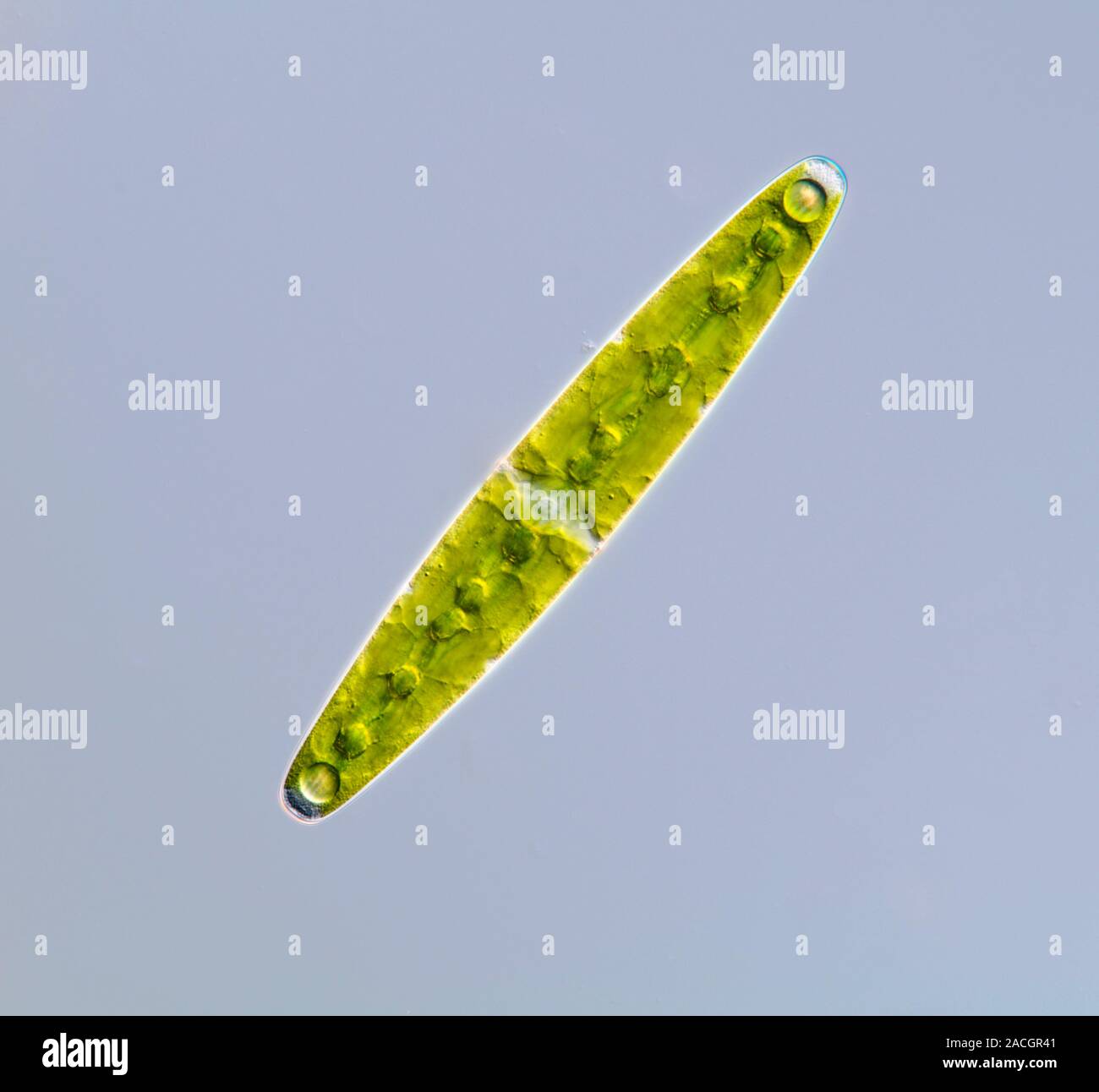 Green alga. Differential interference contrast micrograph of the desmid ...