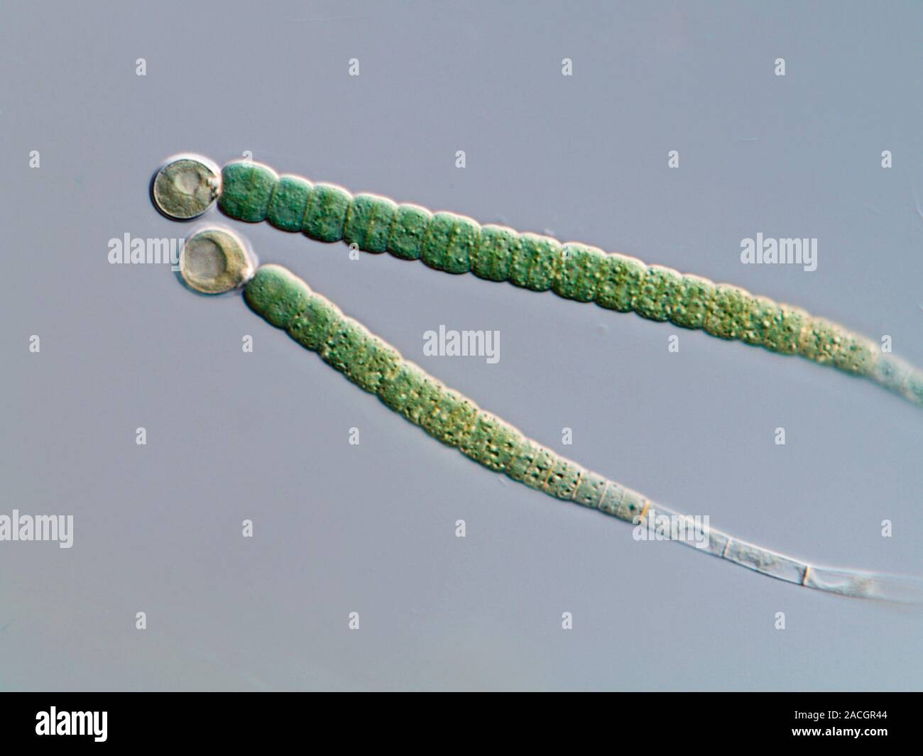 Gloeotrichia cyanobacteria. Differential interference contrast ...