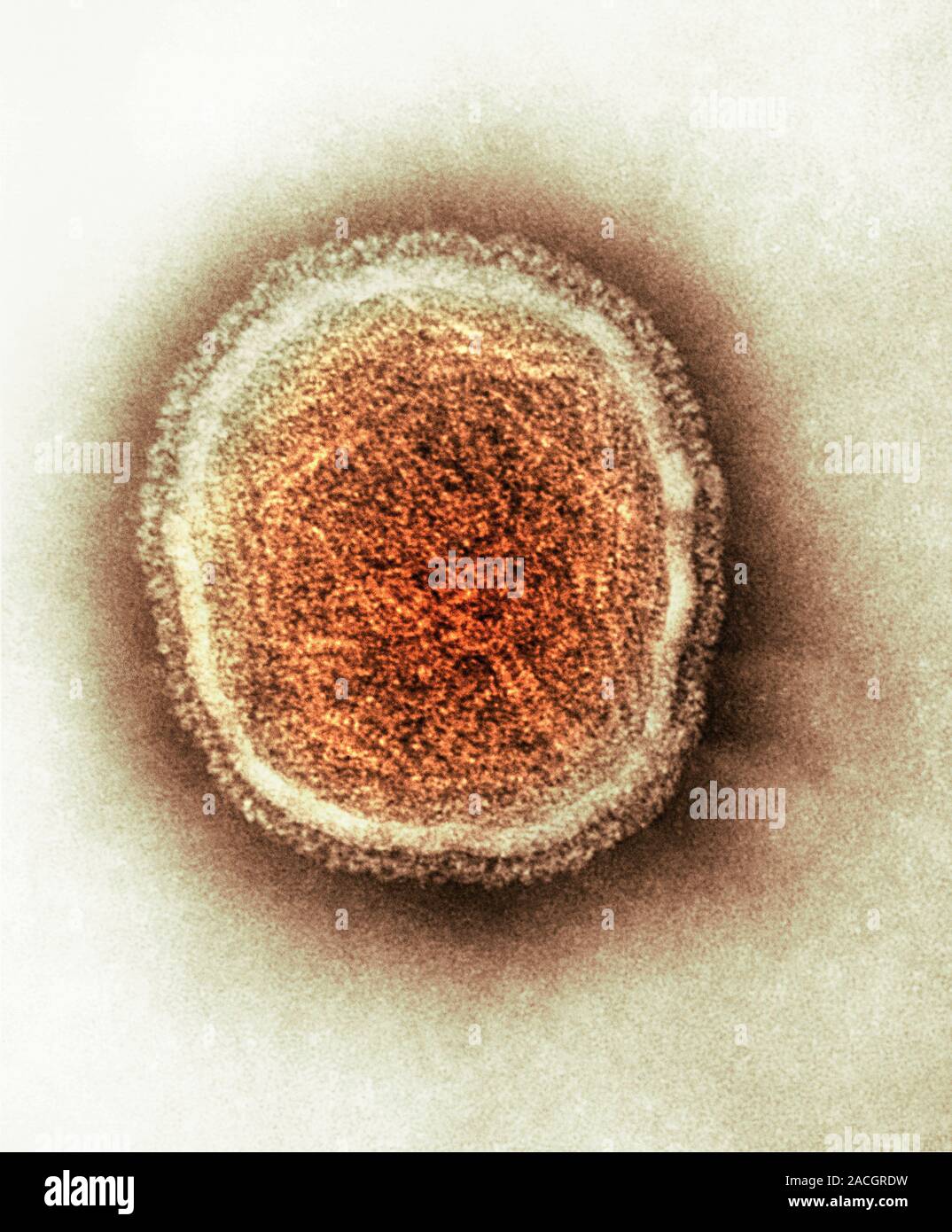 Human parainfluenza virus. Coloured transmission electron micrograph (TEM) of a section through ...