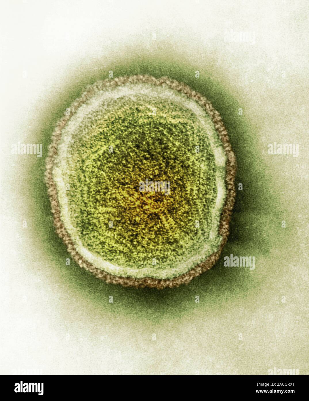 Human parainfluenza virus. Coloured transmission electron micrograph (TEM) of a section through ...