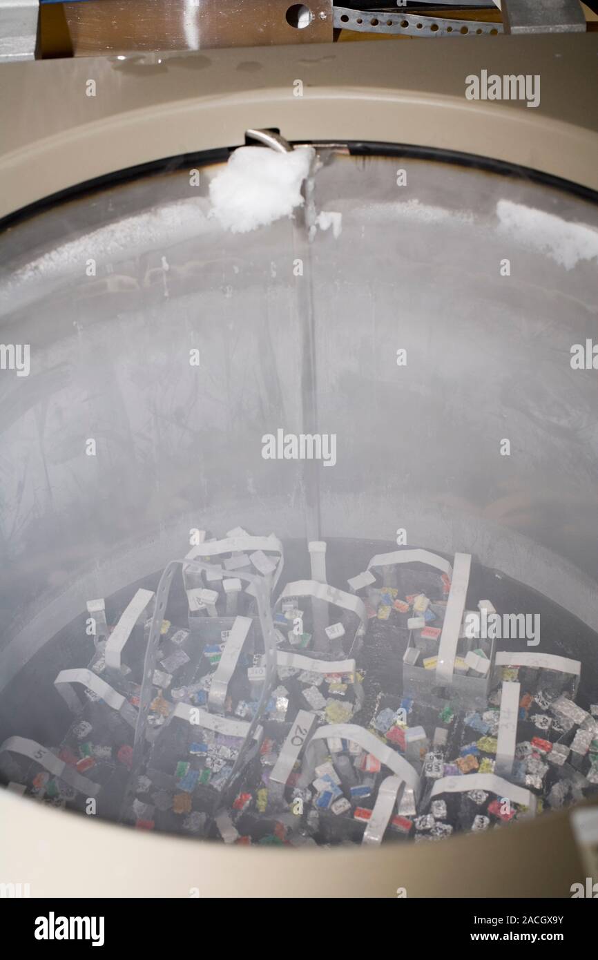 In Vitro Fertilization Lab showing embryo and sperm storage in liquid ...