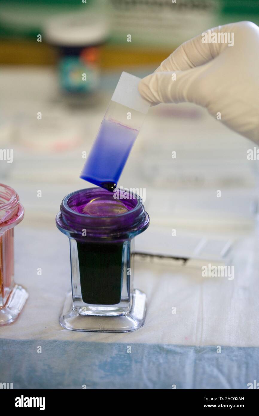 In vitro fertilization laboratory Stock Photo - Alamy