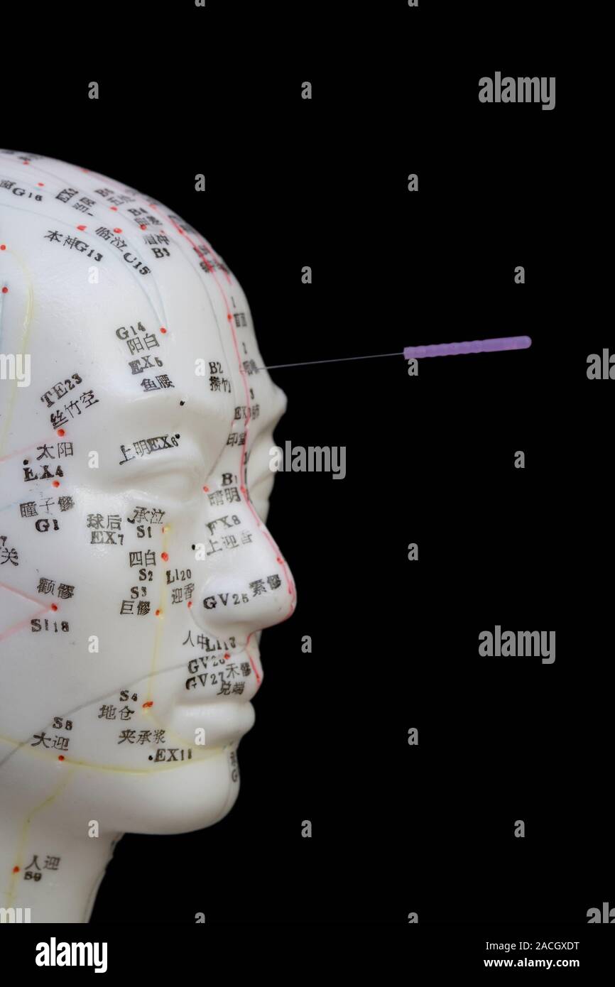 Human model with acupuncture needles inserted in acupressure points ...