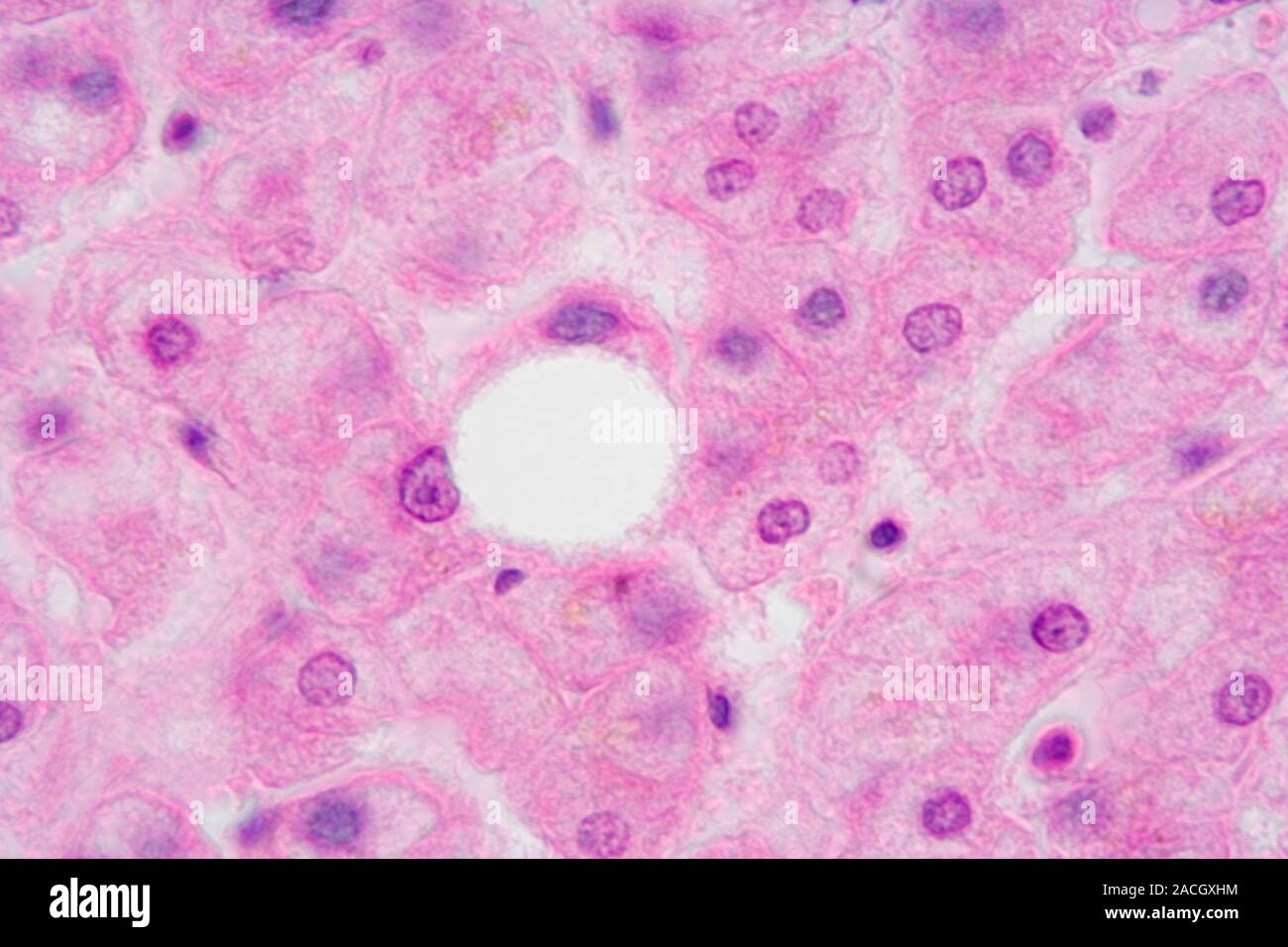 Cross-section of human liver LM X250 Stock Photo - Alamy