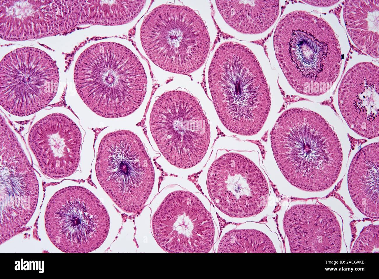 Cross-section of seminiferous tubules in the testis showing ...