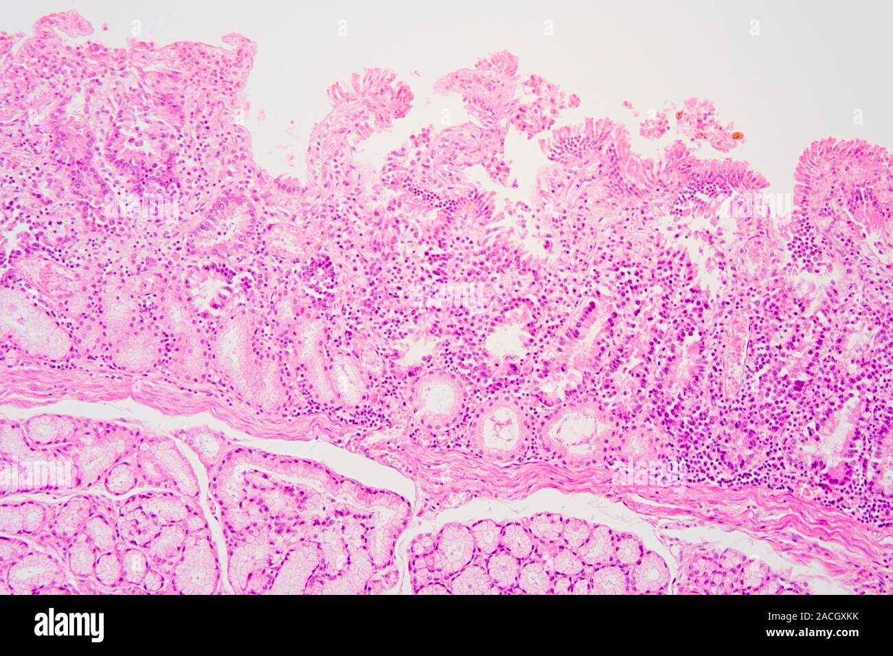 Cross-section of a human gallbladder. LM X25 Stock Photo - Alamy