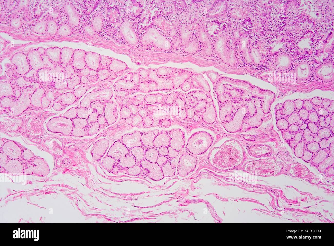 Cross-section of a human gallbladder. LM X25 Stock Photo - Alamy