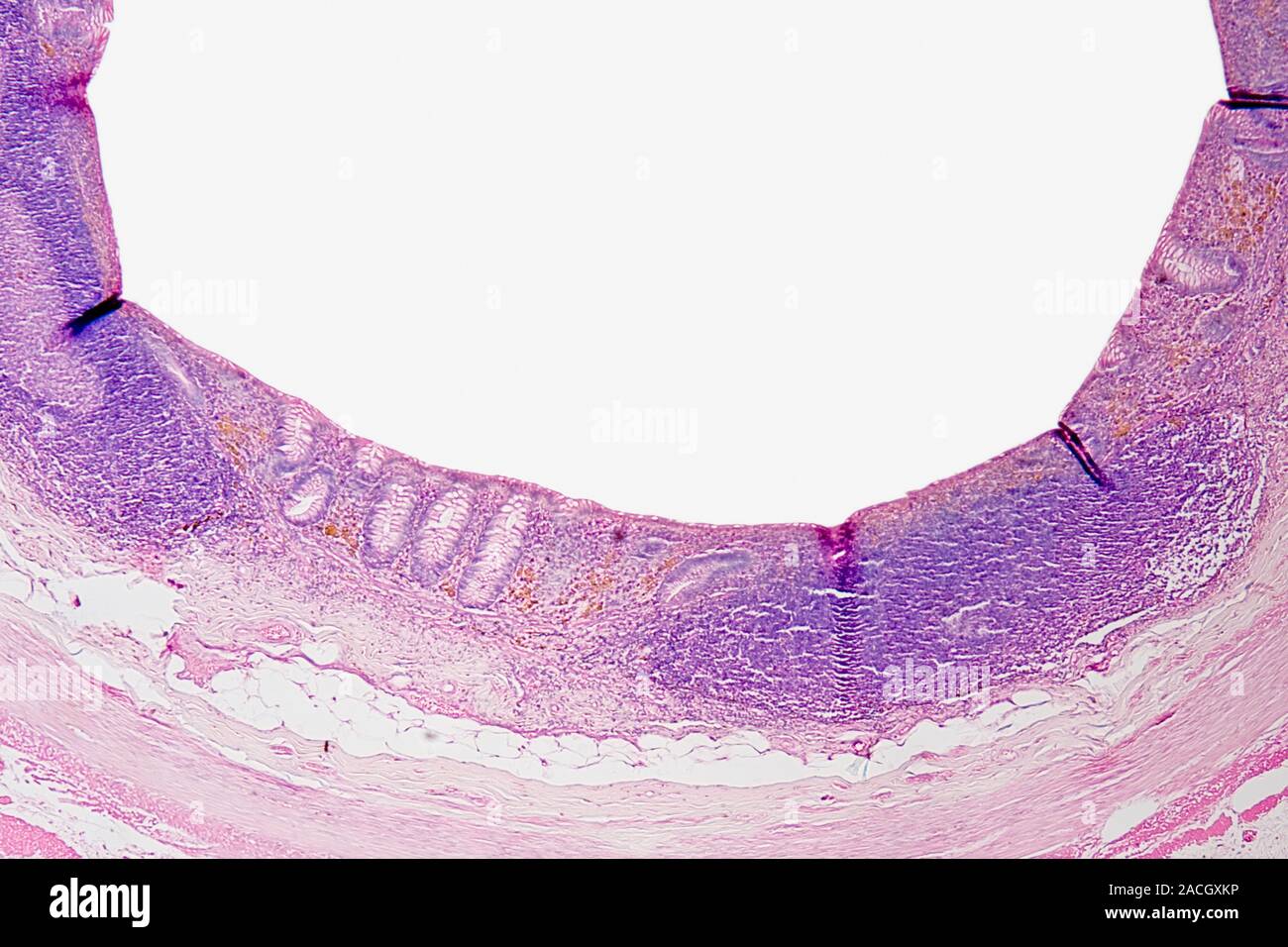 Cross-section of the human appendix. LM. X10 Stock Photo - Alamy