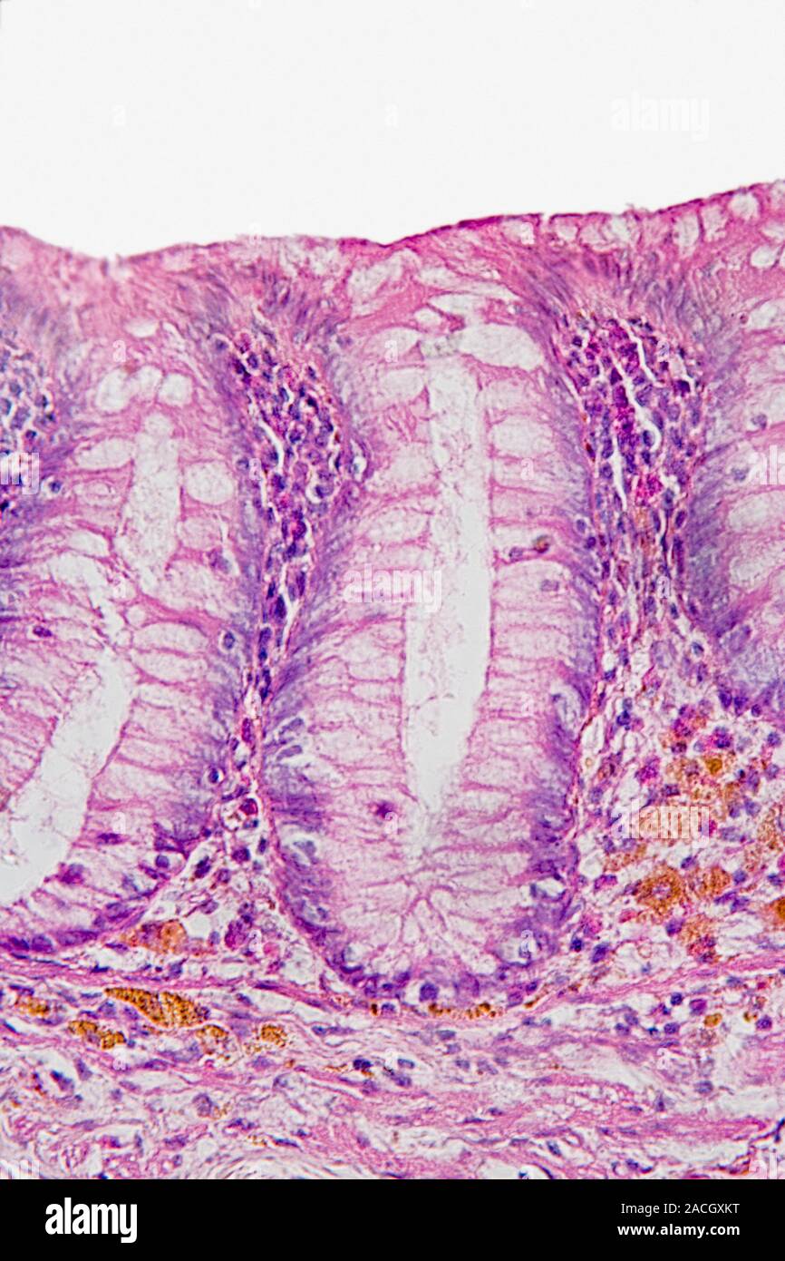 Human Appendix cross section showing simple columnar epithelium. LM ...