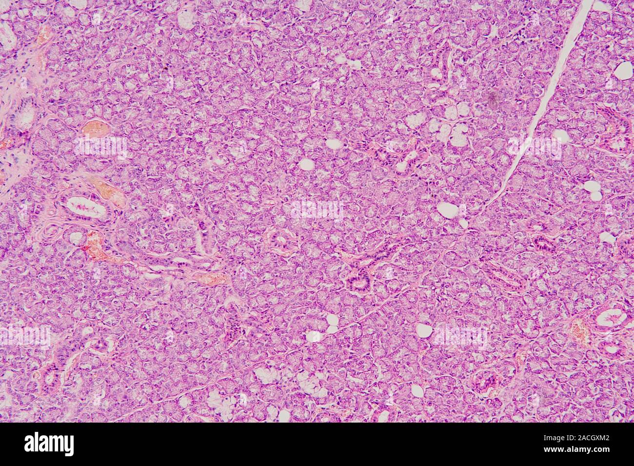 Cross-section of a human submaxillary salivary gland. LM X25 Stock ...