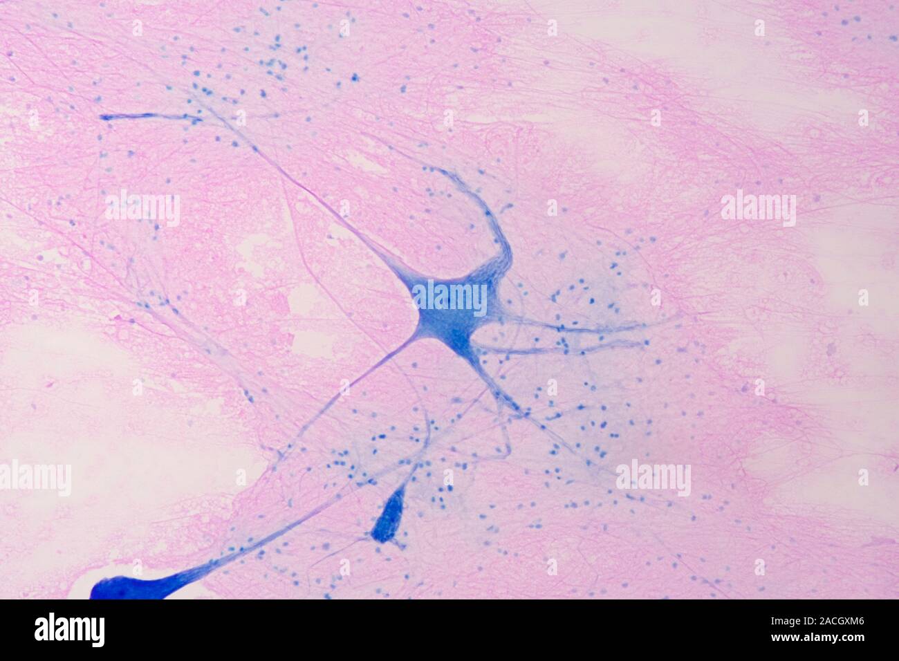 Giant Multipolar Neuron and glial cells. LM X75 Stock Photo - Alamy