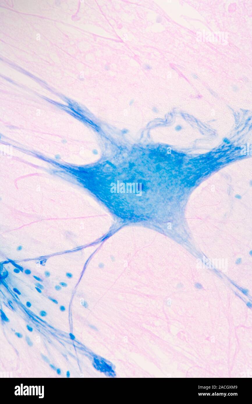 Giant Multipolar Neuron and glial cells. LM X100 Stock Photo - Alamy