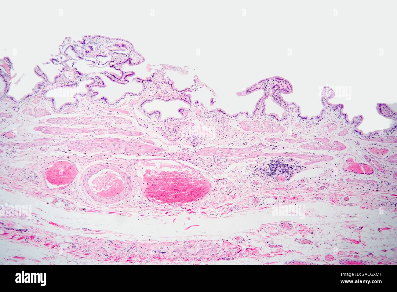 Human Gallbladder section LM X10 Stock Photo - Alamy