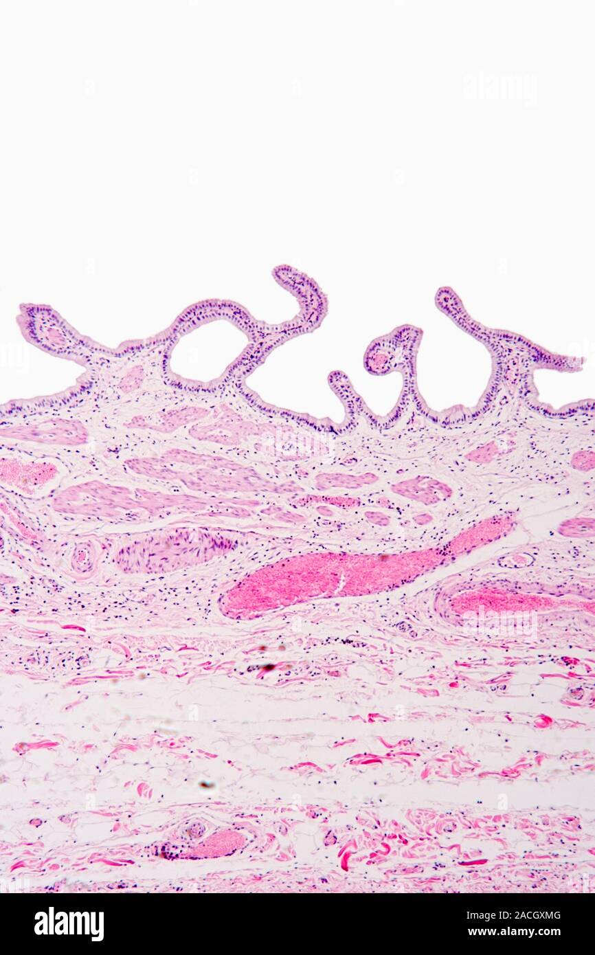 Human Gallbladder section LM X15 Stock Photo - Alamy