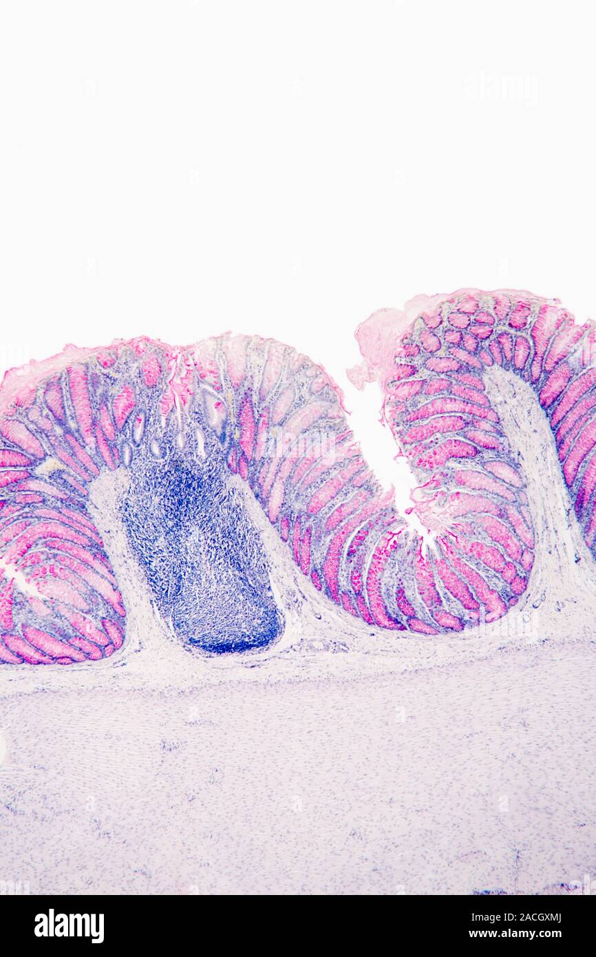 Cross-section of the human colon or large intestine. Muci-Carmine Stain ...