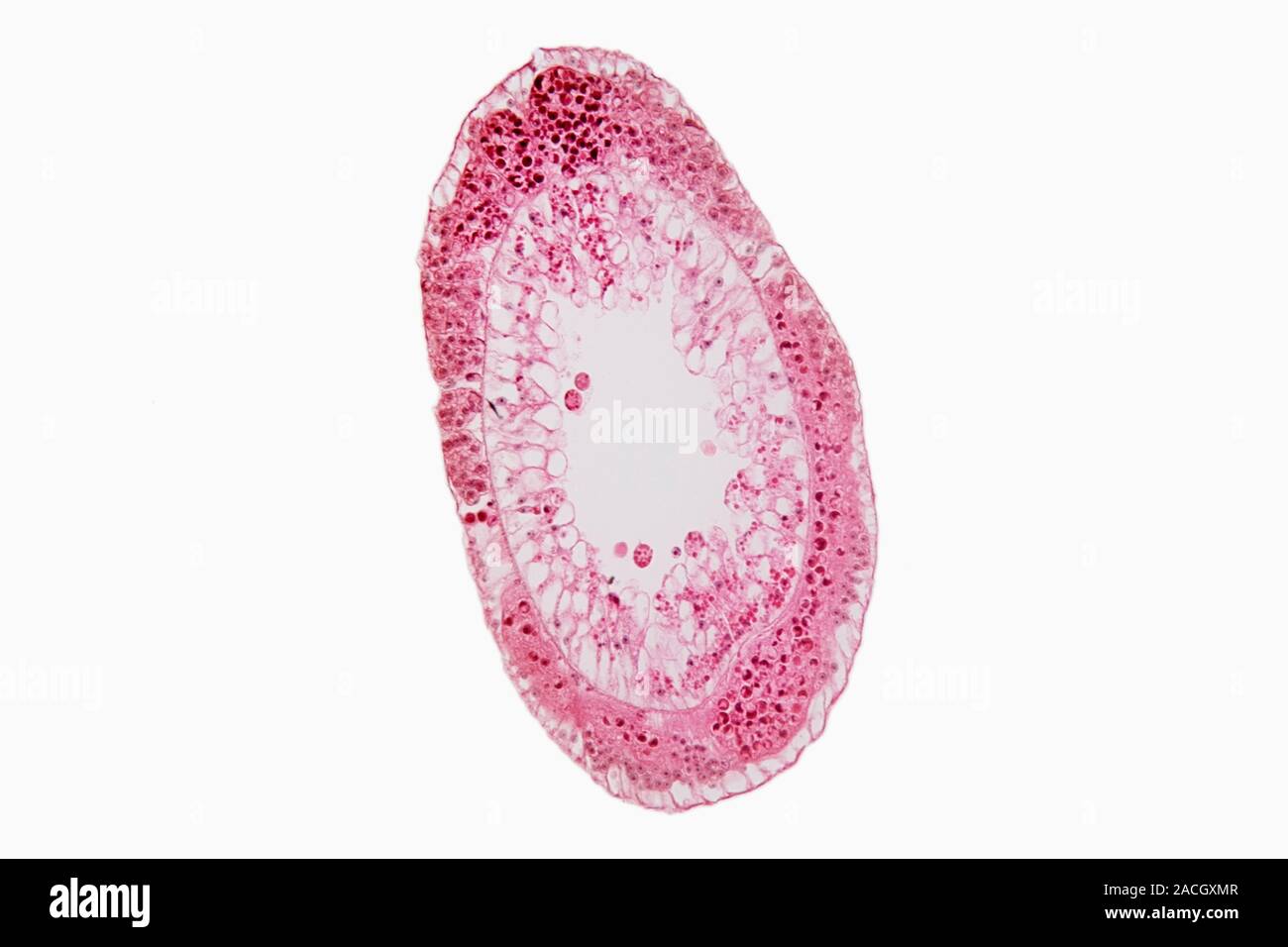 Cross-section of a female Hydra LM X25 Stock Photo - Alamy