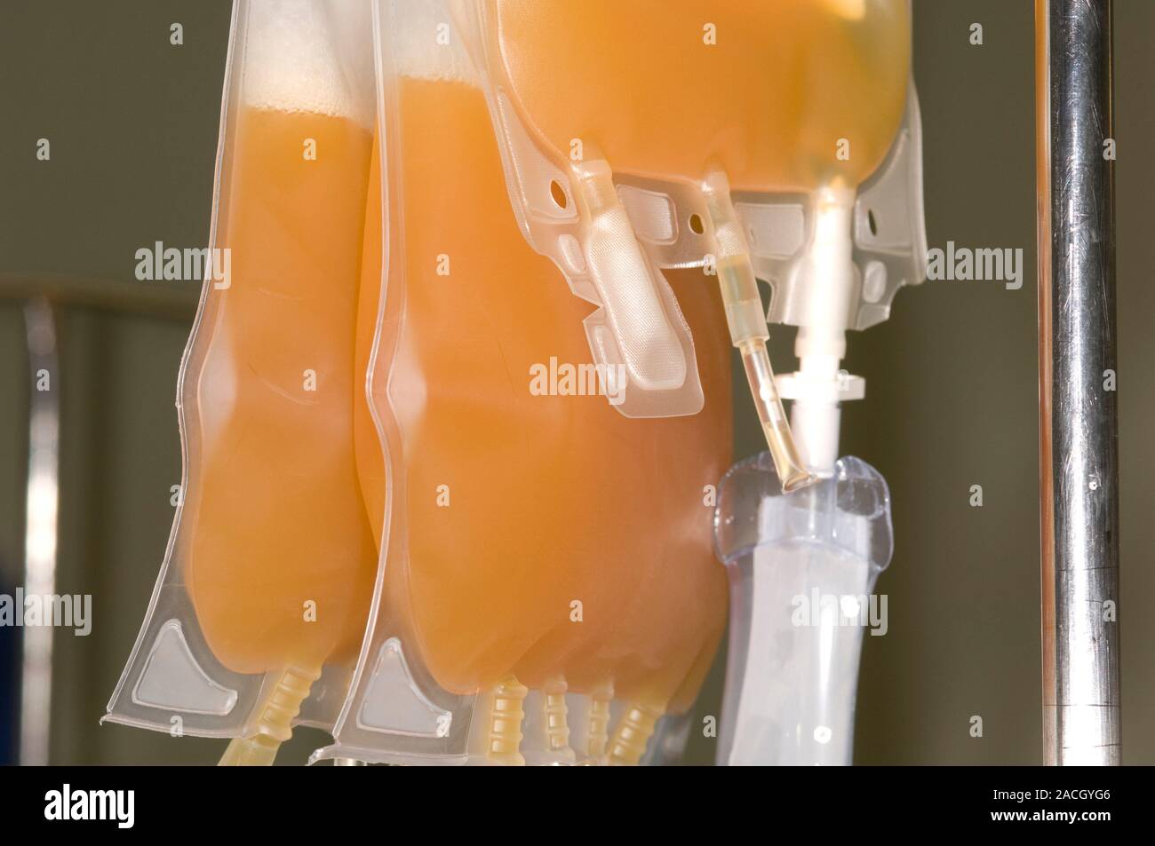 Blood platelets ready for transfusion during surgery. Platelets ...