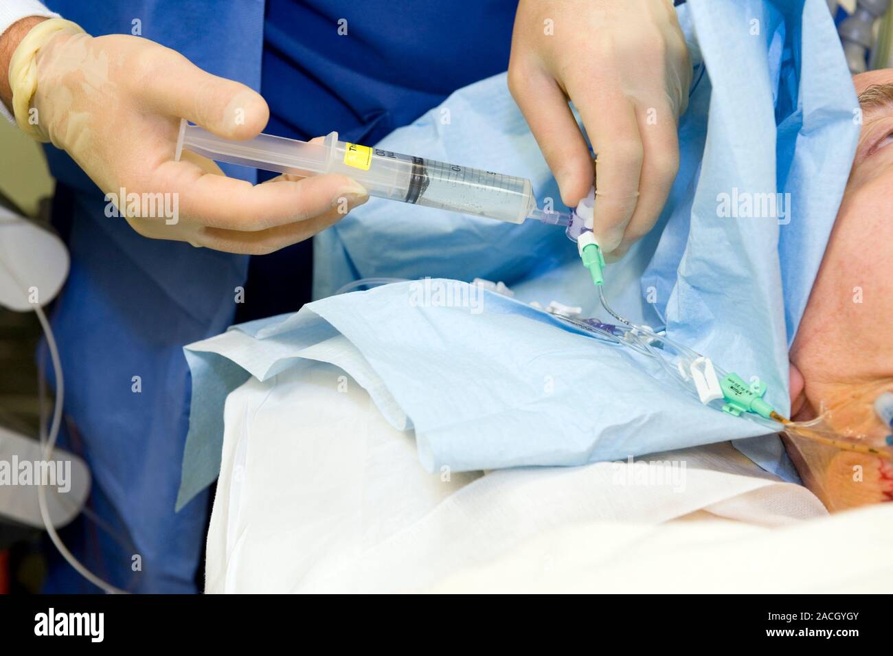 Central line. Anaesthetist injecting a liquid into a patient via a ...
