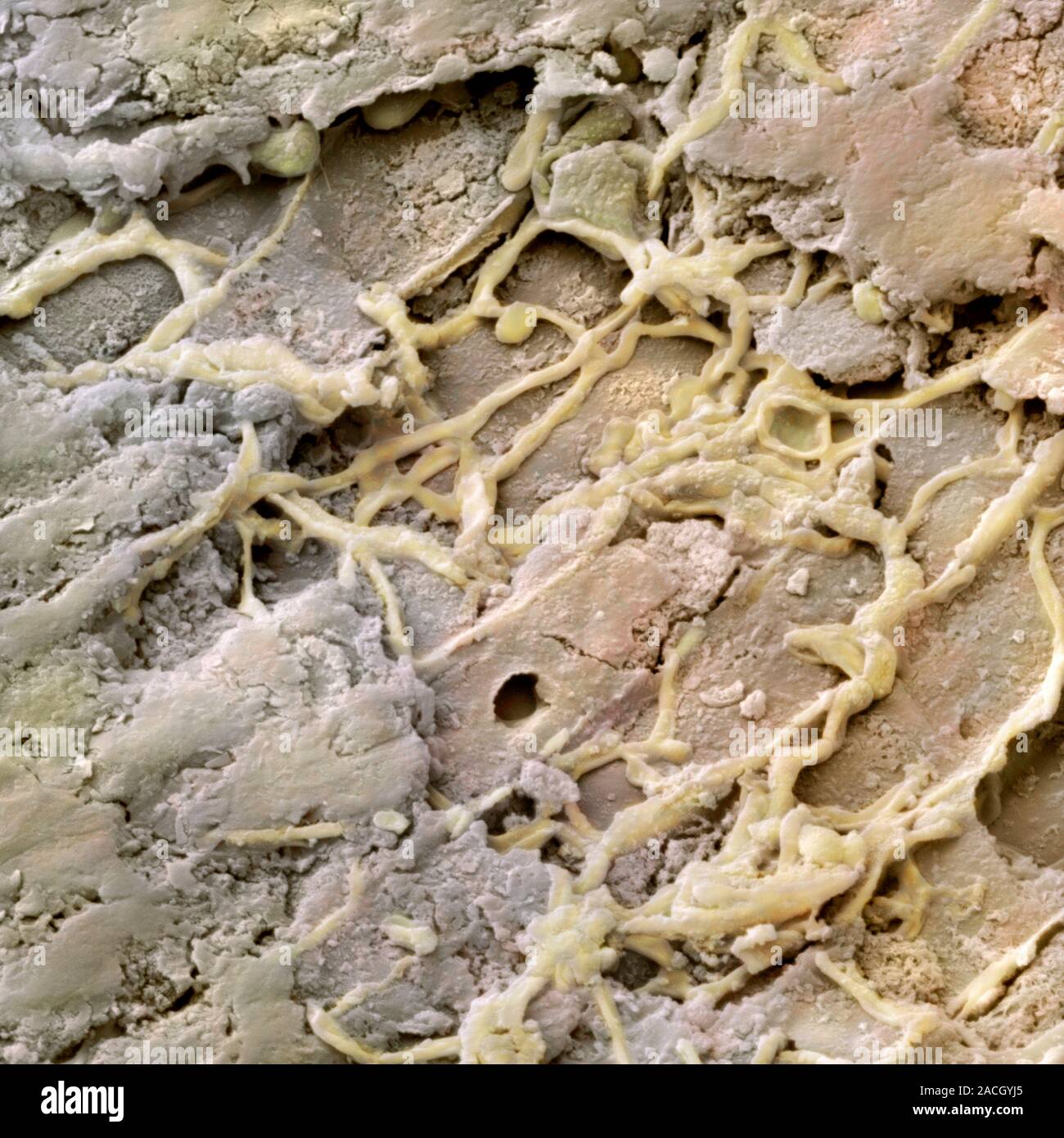 Detail of silver birch bark (Betula pendula), coloured scanning ...