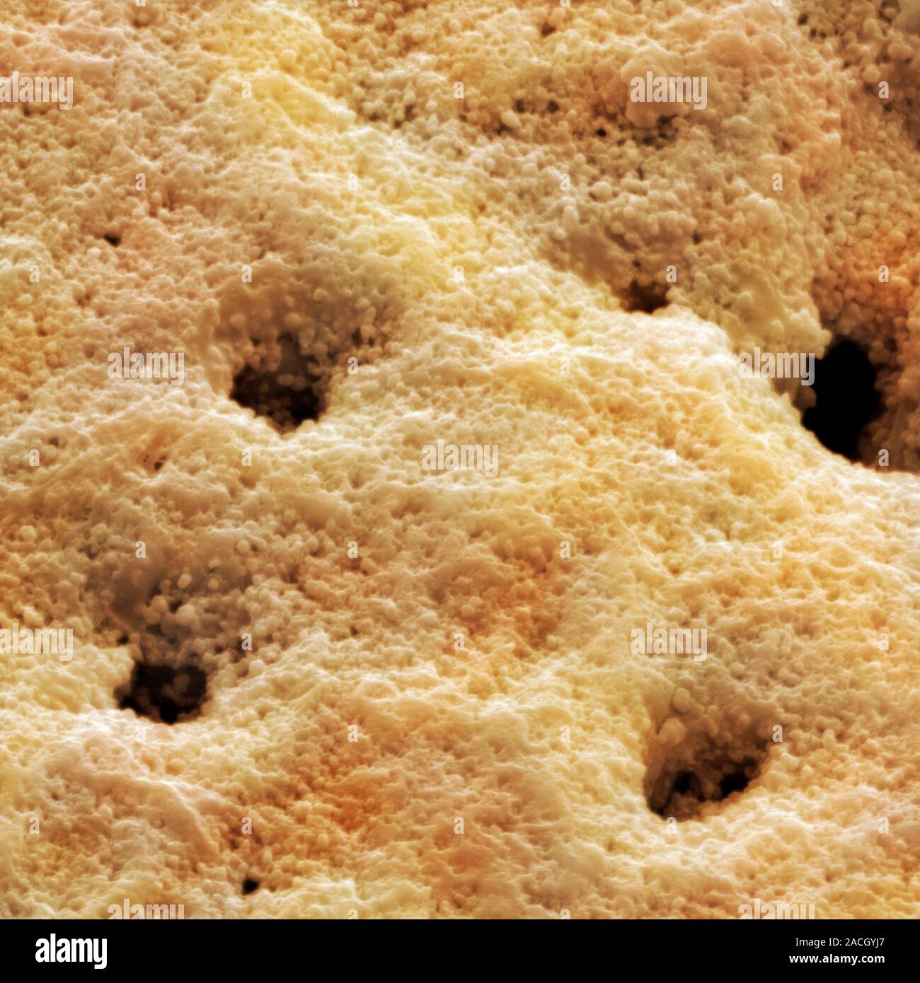 Chicken's egg outer shell detail, coloured scanning electron micrograph ...