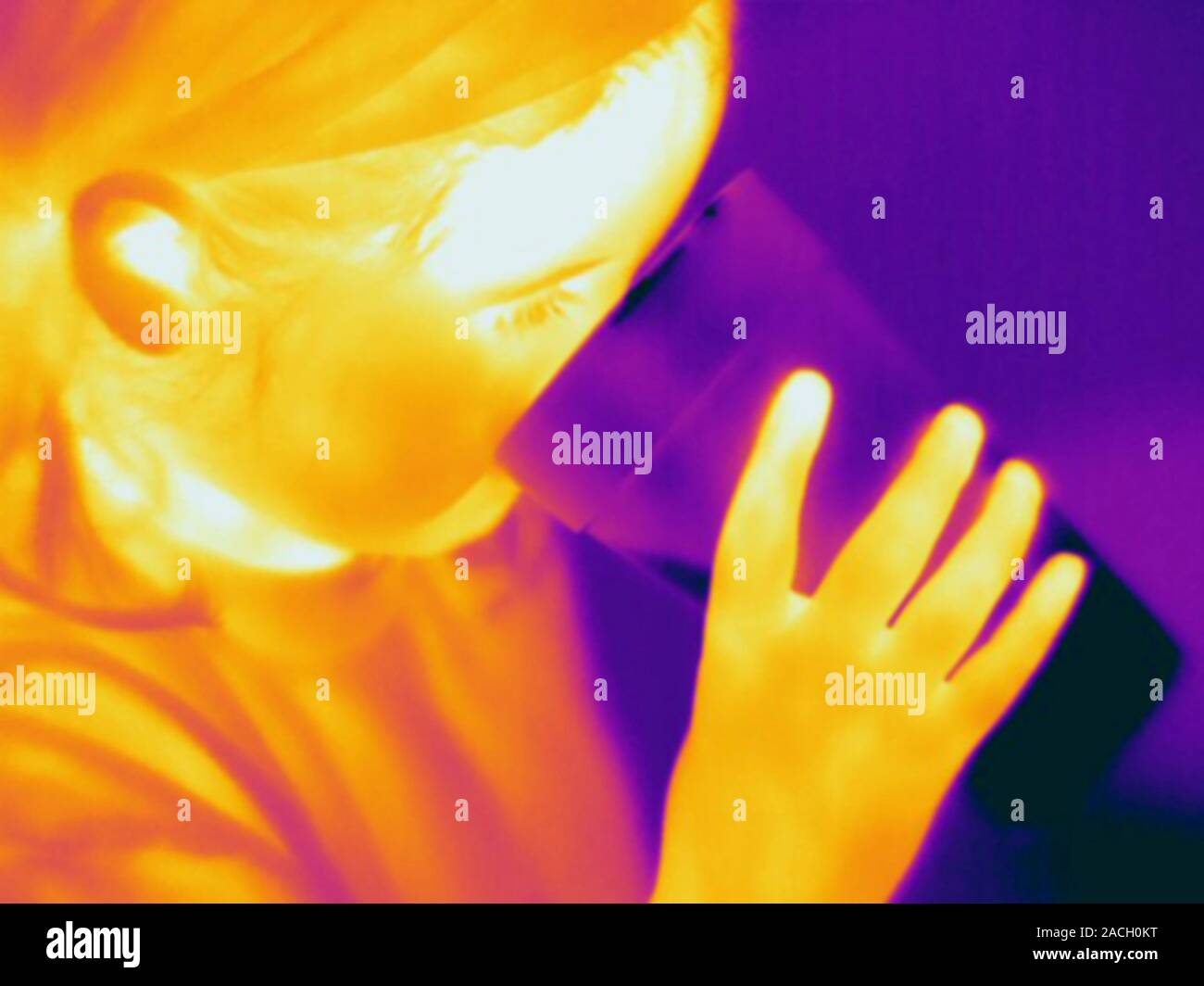 Thermogram - Child drinking cold water - The colors show temperature ...