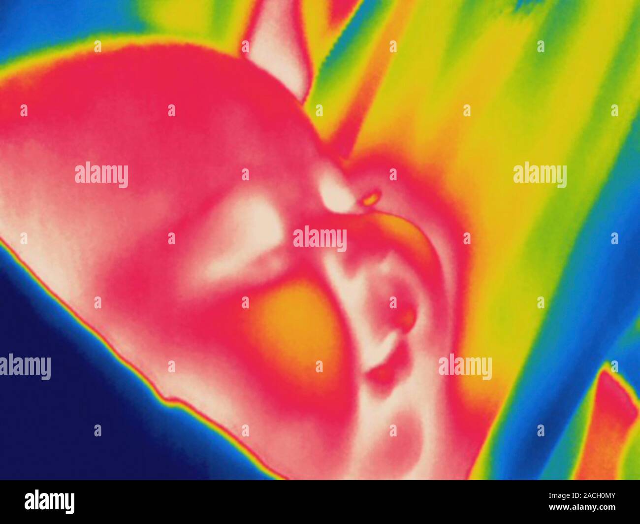 Thermogram - Infant being held close to parent - The colors show ...