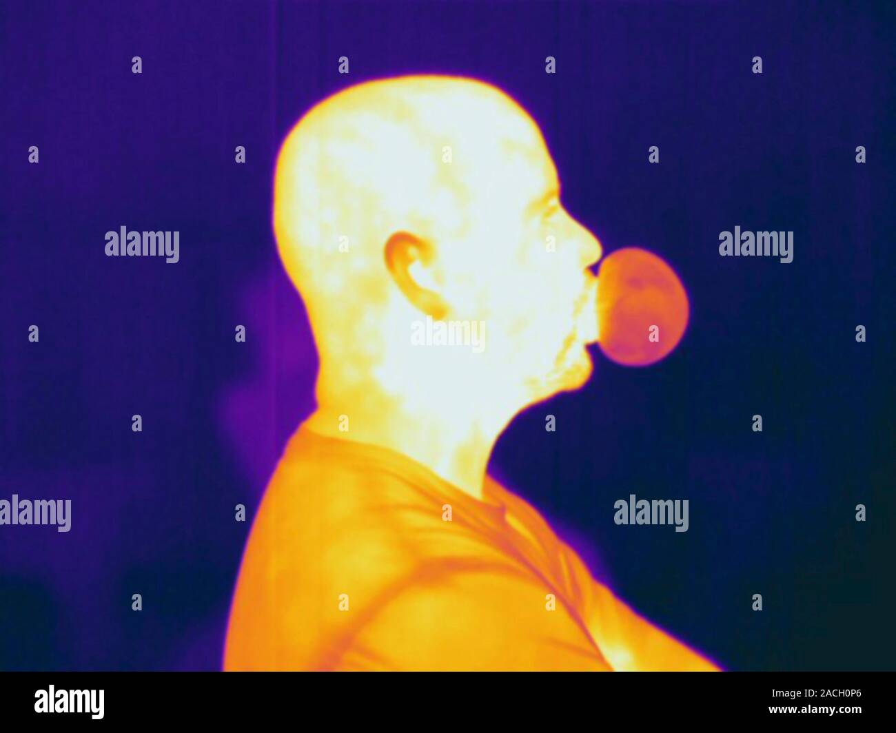 Thermogram showing a man blowing a bubble. The colors show temperature ...