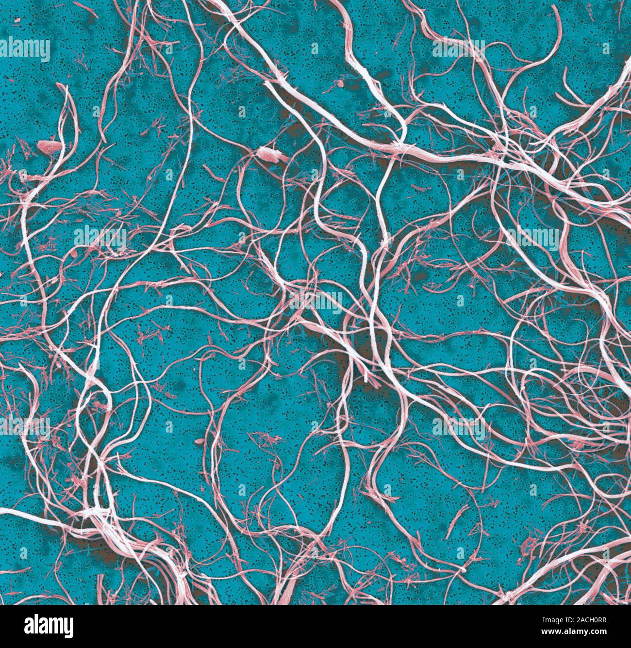 Chrysotile asbestos fibers Stock Photo - Alamy
