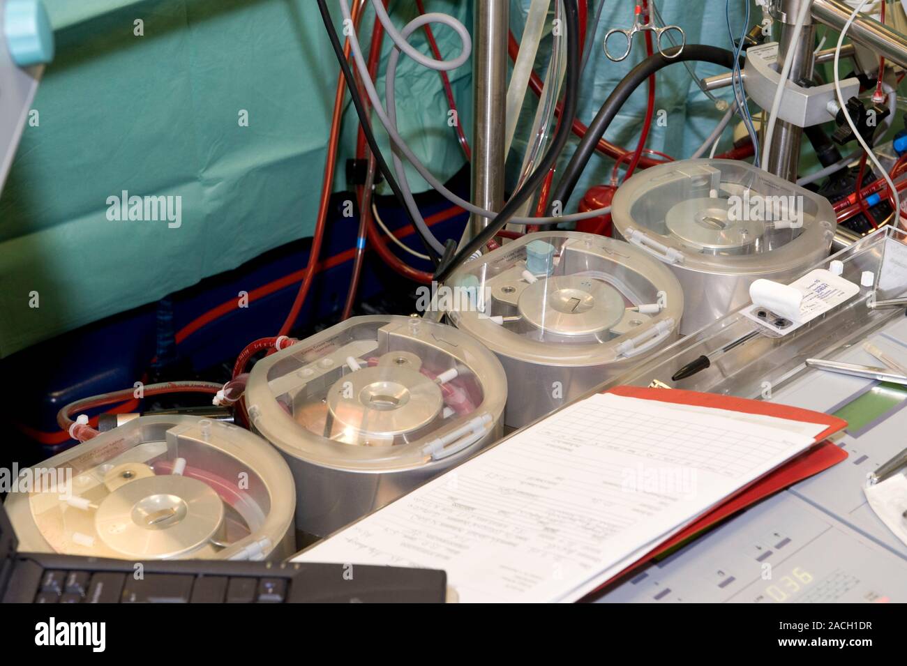 Heart-lung machine in use during heart surgery. A heart-lung machine ...